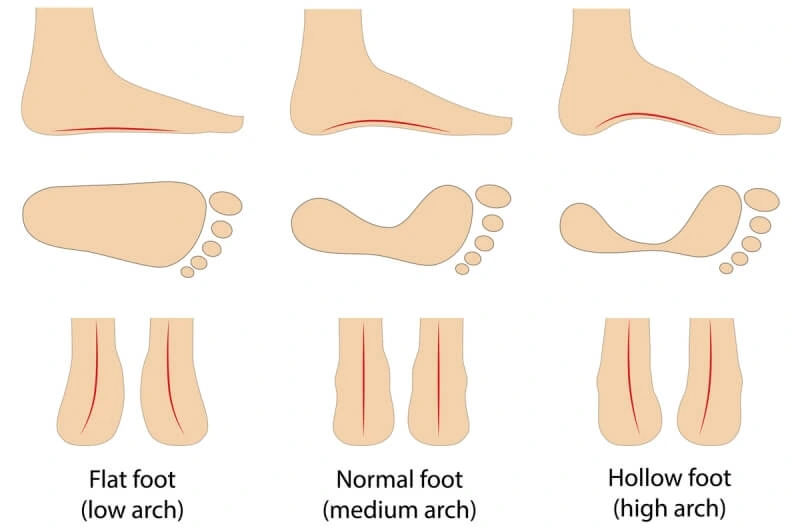 Foot Type Guide 2025: Essential Tools For Your Perfect Fit