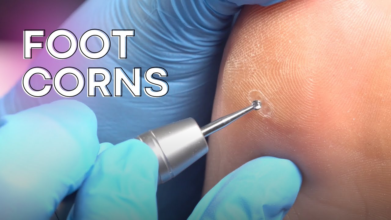 Foot Pain And Discomfort: Causes, Relief, Prevention | 2025